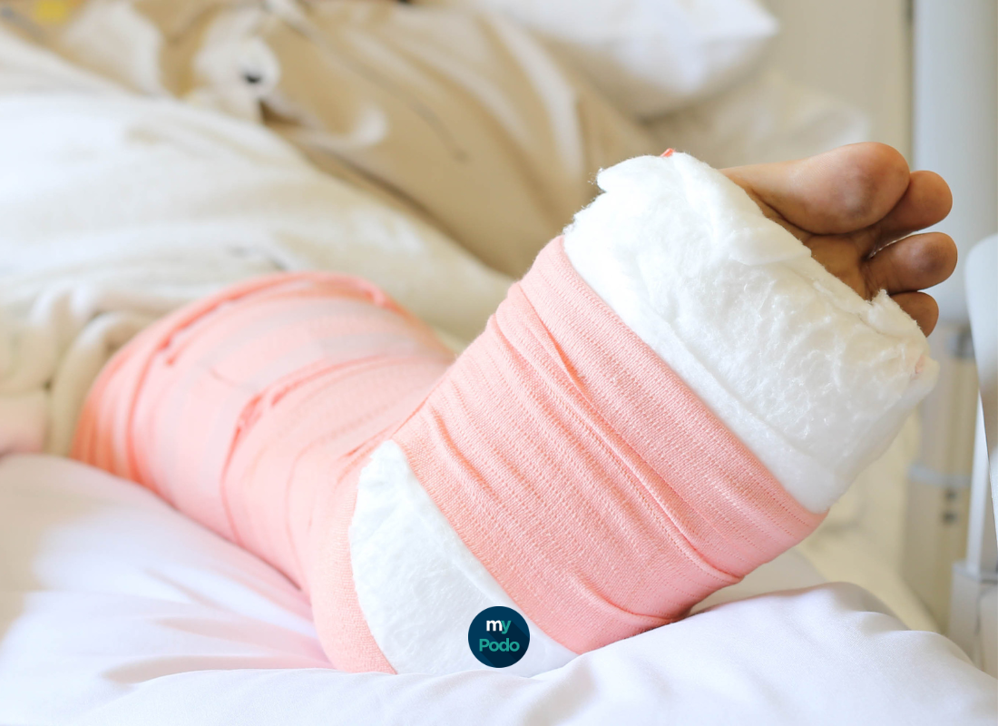 Padding in podiatry | My Podologie